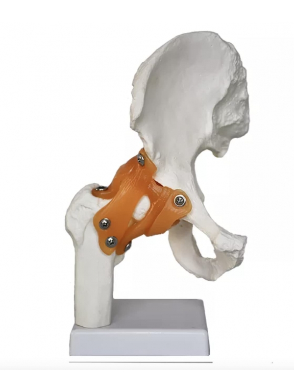 Anatomical Join Model Set Of 5 - Knee, Shoulder, Hip, Foot And Hand Joint Model